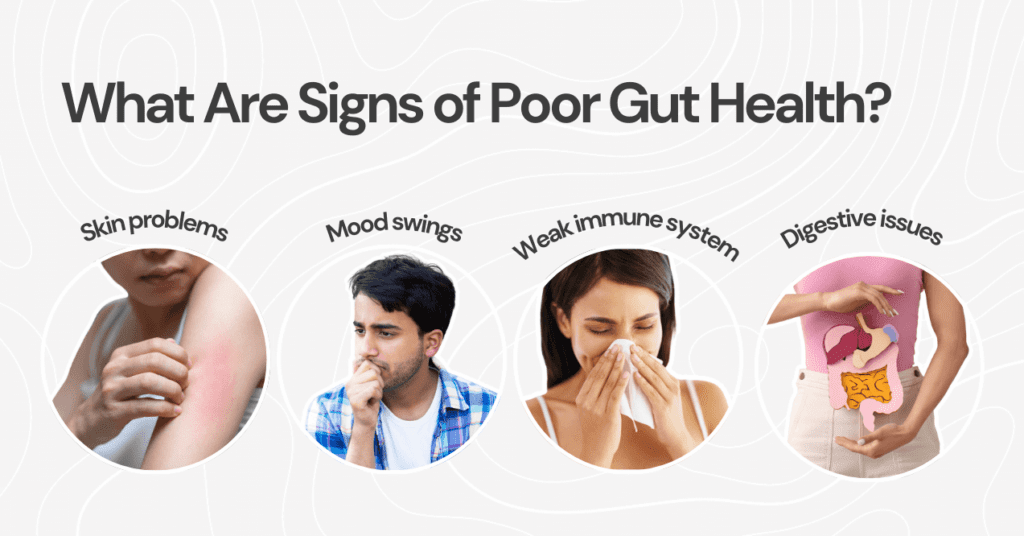 Relationship Between Gut Health and Acne (2025) | Trumeta